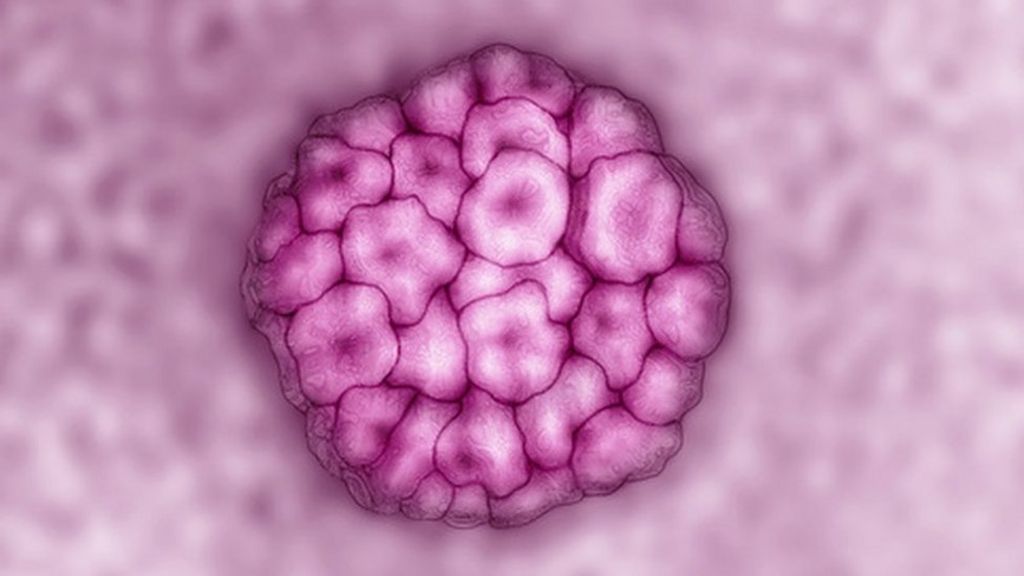 Hpv Cervical Cancer Test Introduced In England Bbc News