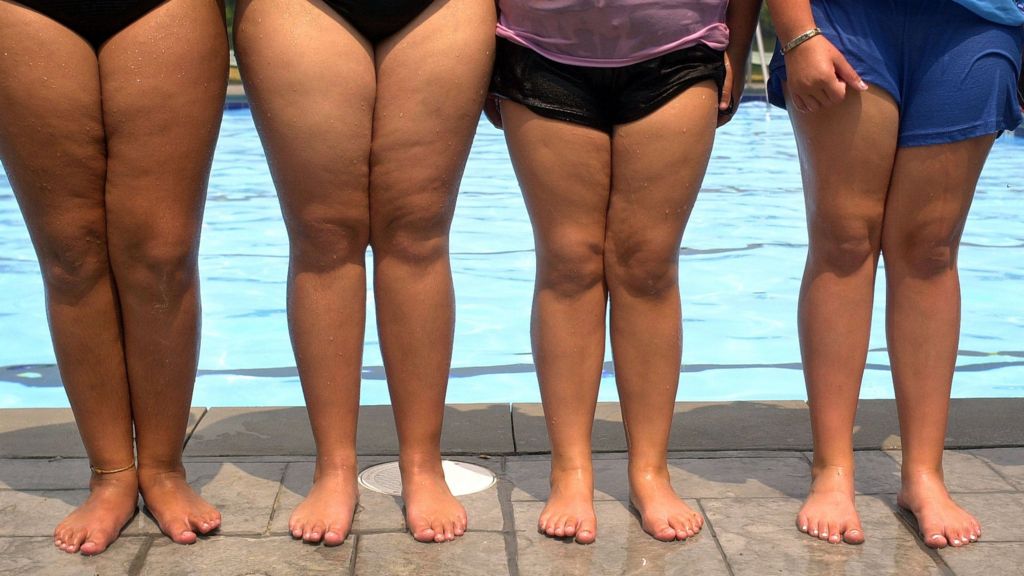 Child Obesity Why Do Parents Let Their Kids Get Fat BBC News Child Obesity Why Do Parents Let Their Kids Get Fat BBC News