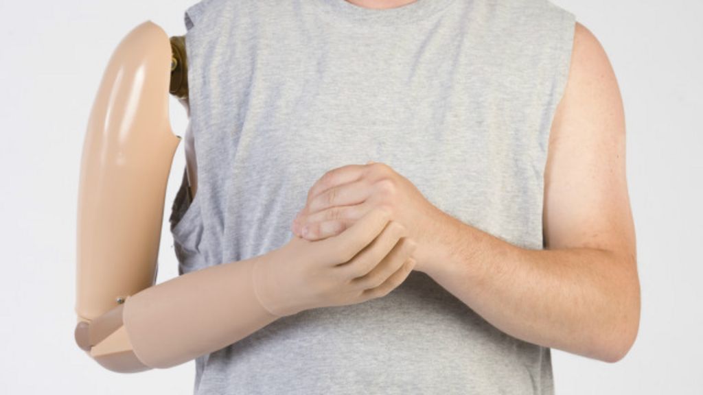 El desafío de tratar el dolor de los miembros amputados - BBC Mundo